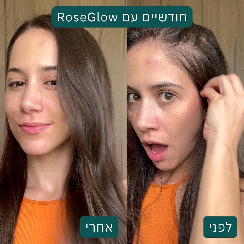 שמן רוזמרין מנטה טבעי לצמיחת שיער - RoseGlow – IntSuper Israel